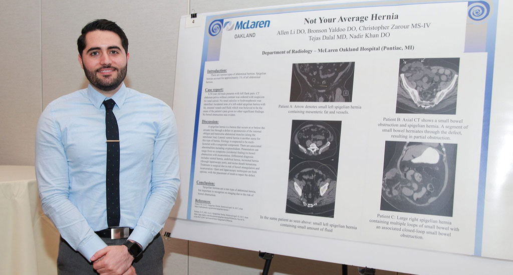 UMHS Student Christopher Zarour Discusses Hernias & Ulcers at Poster ...
