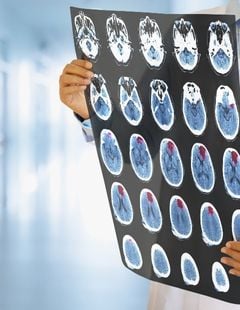 How to become a Neurologist - Eight steps after high school to ...