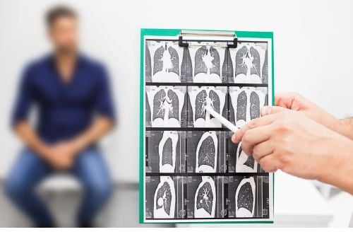 What is a Pulmonologist and Pulmonary Medicine?