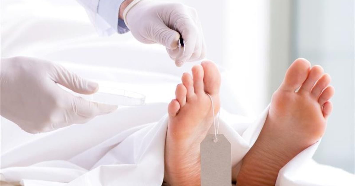 Coroner versus medical examiner