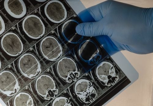 How to become a Neurosurgeon? - A step-by-step guide