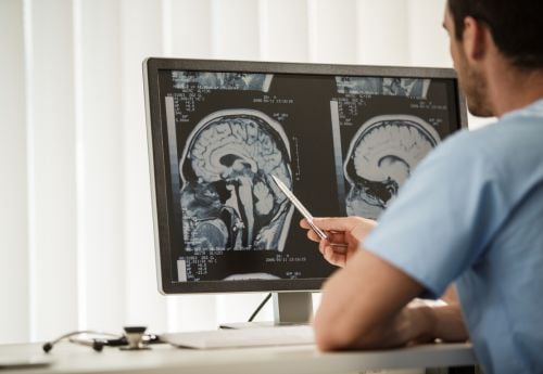 How to become a Neurosurgeon? - A step-by-step guide